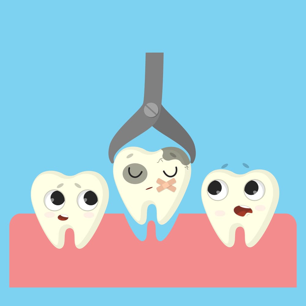 Extracting Teeth – Bad Teeth Out, Summer Smiles In | Ocoee Oral Surgery